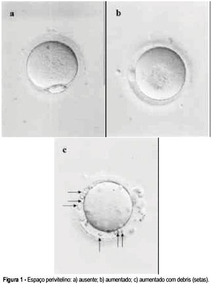 Relationship Between Oocyte Morphology And Fertilization Rate After