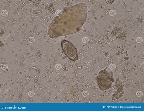 Huevo De Parásito En Pruebas De Exploración De Heces Imagen De Archivo