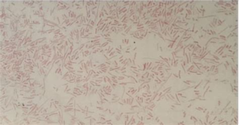 Micro Lab Midterm Flashcards Quizlet Micro Lab Midterm Flashcards Quizlet