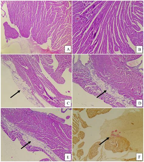 Sex Specific Biochemical And Histopathological Effects Of Chronic Meat