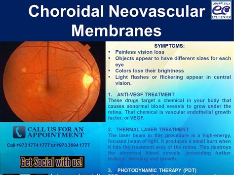 Choroidal Neovascular Membrane