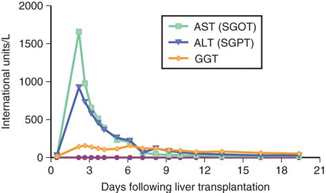 Hepatic Transplantation Musculoskeletal Key