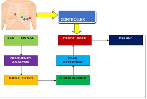 Figure 2 From Design And Analysis Of Electrocardiograph Ecg Signal For Long Term Continuous