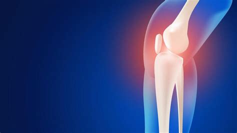 Cartilage Degeneration Vector Art Icons And Graphics For Free Download