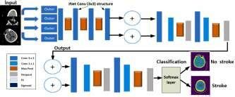 The Proposed Hybrid CNN Scheme For Brain Stroke Diagnosis On The C Net Download Scientific