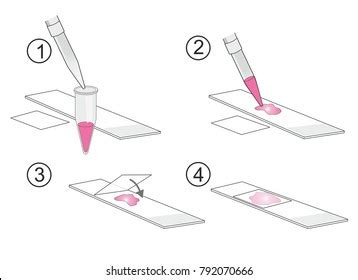 Microscope Slide Preparation Images Stock Photos And Vectors Shutterstock