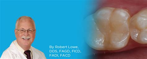 Dr Lowe Posterior Composite Resin Restoration Article Image Clinicians Choice Dental Products