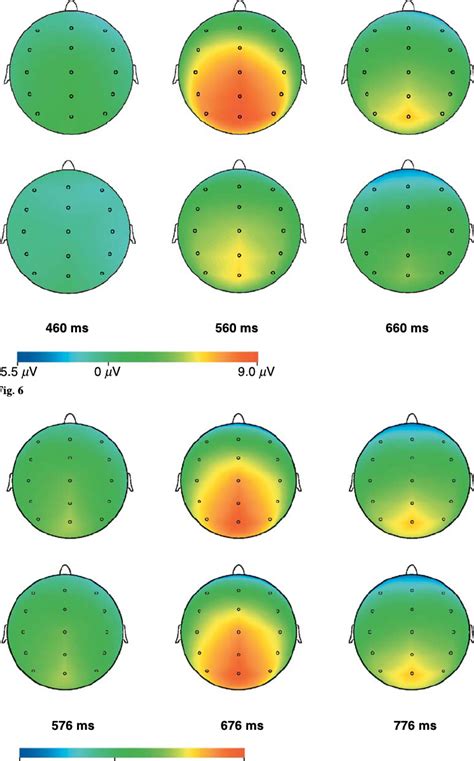 Scalp Topography For The Difference Curve In The Graphic Material