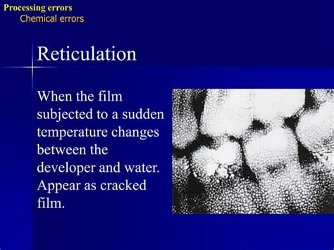 Radiographic Errors And Artifacts Pptx Photo Editing Software Computer Software And