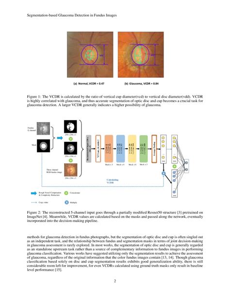 Segmentation Based Information Extraction And Amalgamation In Fundus Images For Glaucoma
