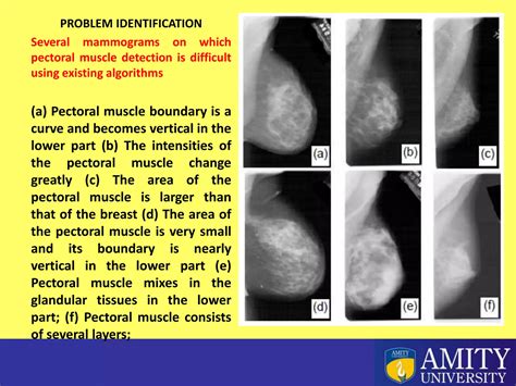 Design Of Modified Bio Inspired Algorithm For Identification And