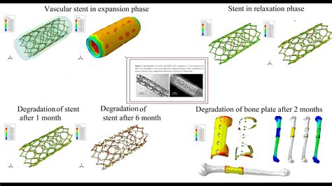 Modelling Degradation In Biodegradable Pla Bone Plates And Vascular Stents With Abaqus Via Vusdfld