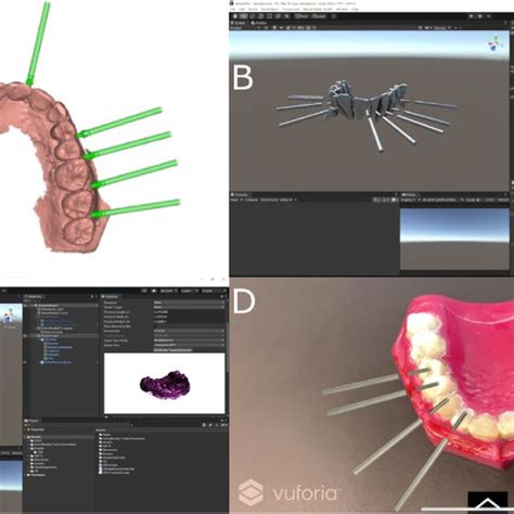 A Dicom Files From The Cbct Scan B Render Stl Digital File From The Download Scientific