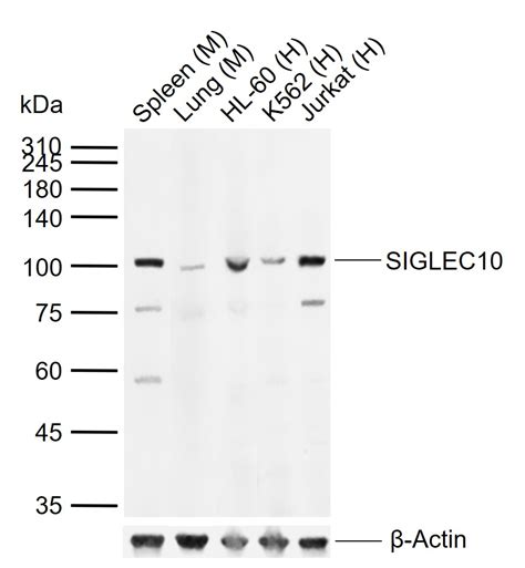 Siglec10 Polyclonal Antibody Bioss