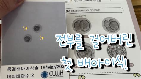 시험관vlog 이식준비하기💉대망의 배아이식날 이제 나에게 남은배아는 없다 Youtube
