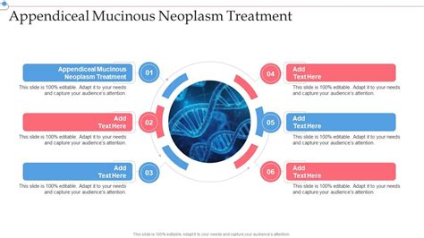 Appendiceal Mucinous Neoplasm Treatment In Ppt Powerpoint Presentation Slide Templates Cpp Ppt
