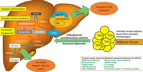 Complications Morbidity And Mortality Of Nonalcoholic Fatty Liver Disease Metabolism