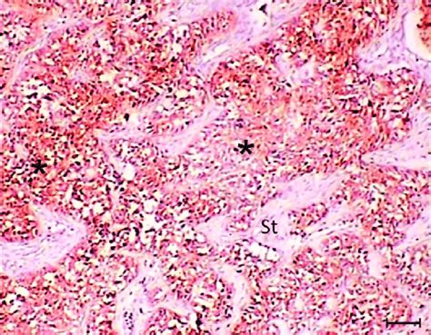 Immunohistochemical Staining Of The Testis Of The Mynah Described In Download Scientific