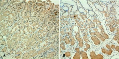 Immunohistochemistry For RUNX3 Protein Expression In The Corpus Mucosa Download Scientific