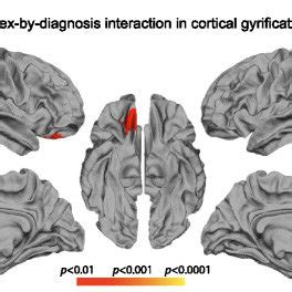 Sex By Diagnosis Interaction Local Gyrification A Whole Brain Download Scientific Diagram