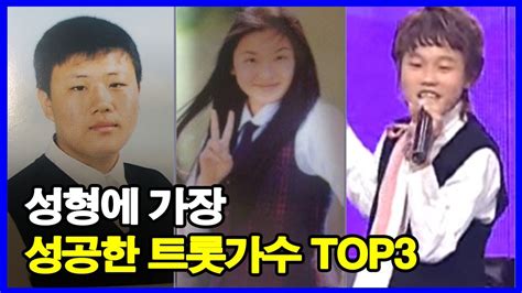 성형에 가장 성공한 트롯가수 Top3 Youtube
