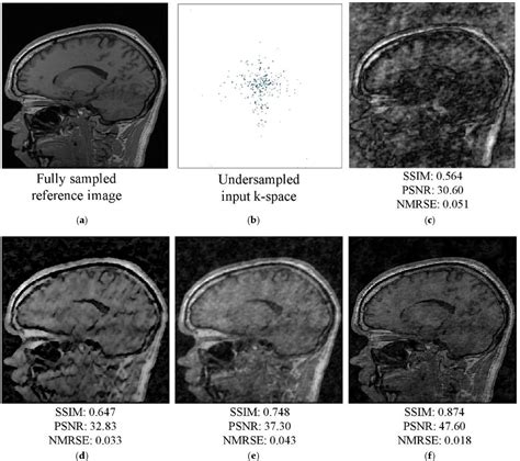 Figure 2 From A Hybrid Residual Attention Convolutional Neural Network