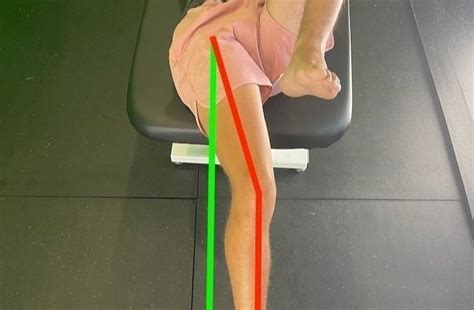 Positive Thomas Test