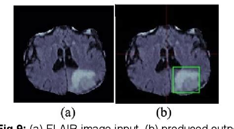 Figure 1 From An Integrated Thresholding And Morphological Process With