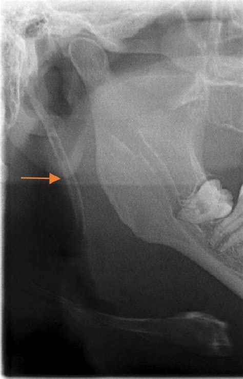 Radiograph Show Type 0 Elongated Styloid Process Figure 2 Radiograph