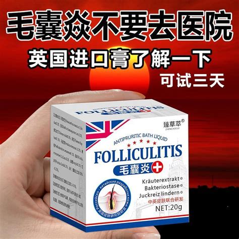 Spot Scalp Folliculitis Ointment Special Tinea Capitis Seborrheic