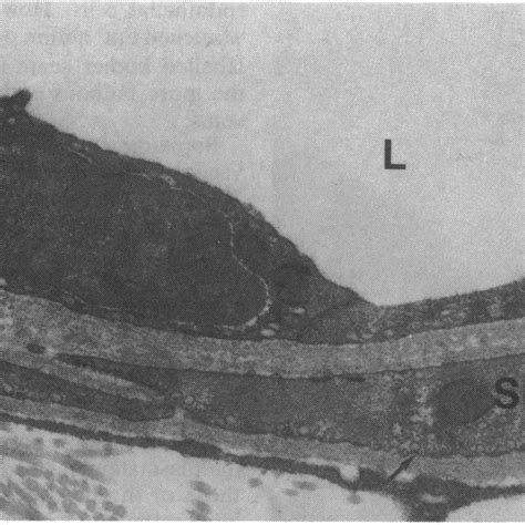 Choroidal Artery Rat Perfusionfixation The Plasmalemmal Caveolae