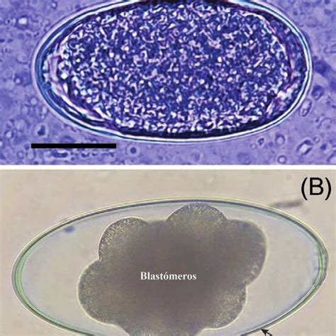 Rhipicephalus Boophilus Microplus A Macho Adulto Vista Ventral