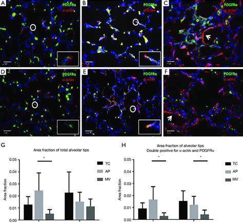 Immunostaining For Markers Of Lung Development Representative Slides