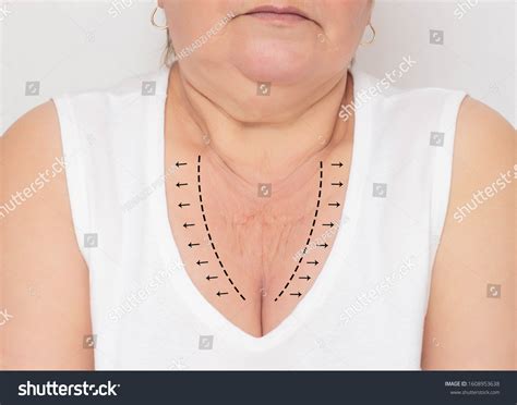 1924 Wrinkled Wrinkled Chest 图片、库存照片和矢量图 Shutterstock