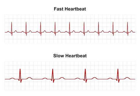 Abnormal Echocardiogram Results