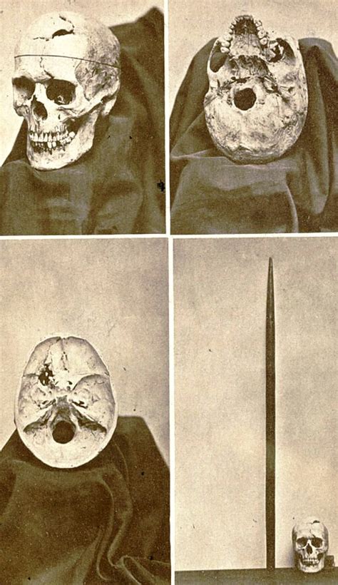 Phineas Gage Wikipedia