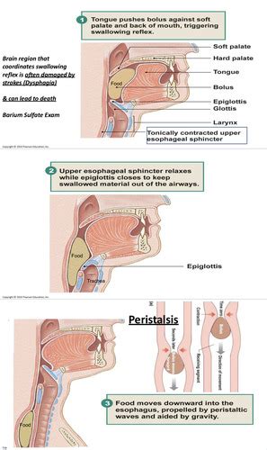 GERD PUD Pharmacology Flashcards Quizlet