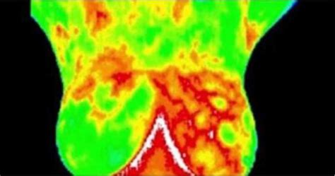 Things I Wish All Women Knew About Mammograms