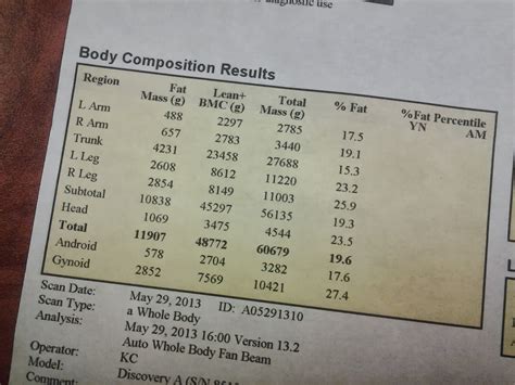 How I Complicated My Life Today DEXA Scan Bone Density Test