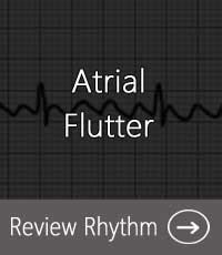 ACLS EKG Rhythms Interpretation ACLS Algorithms Com