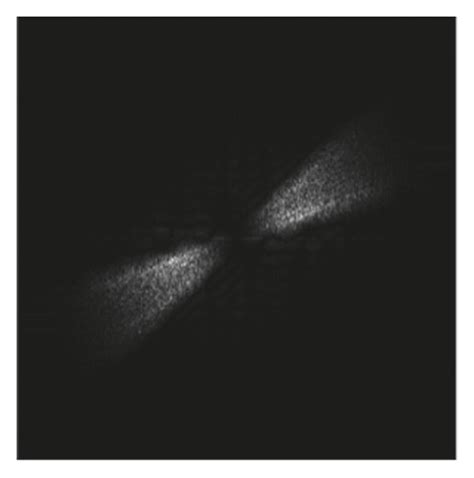 Directional Subbands Diagram After Shearlet Decomposition Download Scientific Diagram