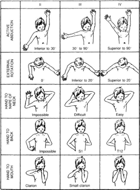 Mallets Classification Of Function In Obstetrical Brachial Plexus Download Scientific Diagram