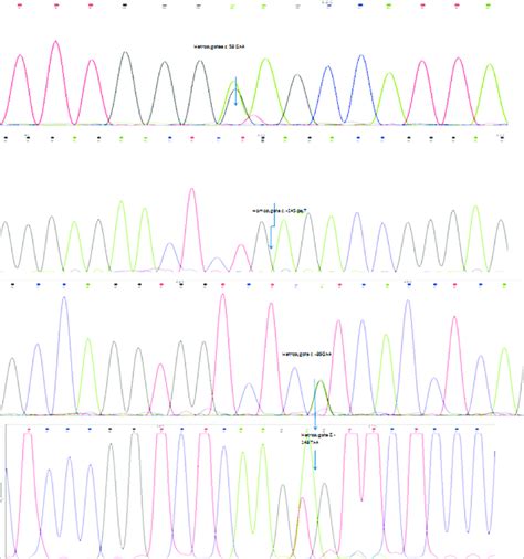 Sequencing Results Of Detected Four Polymorphisms Among Patients With