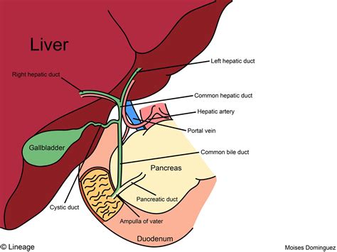 Ascending Cholangitis Gastrointestinal Medbullets Step 23