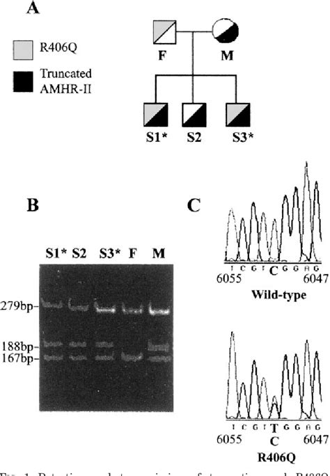 Figure 1 From Autosomal Recessive Segregation Of A Truncating Mutation Of Anti Müllerian Type Ii