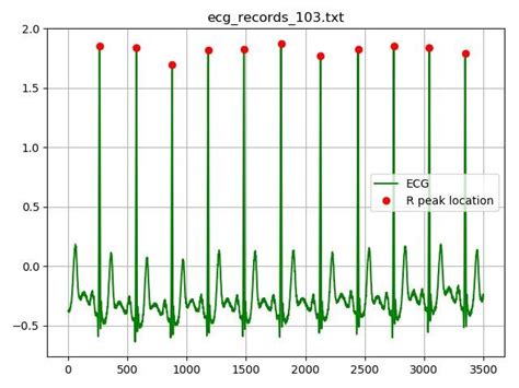 Schematic Diagram Of R Peak Positioning Download Scientific Diagram