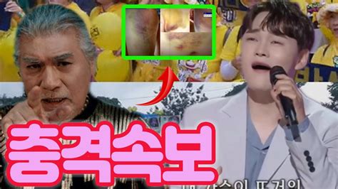 충격 온통 멍이 든 박서진의 얼굴 보고 당황한 나훈아 누가 감히 박서진을 때리겠어 말도 안 돼나훈아는 화가 났다 진실은 어떤가 박서진의 장난인가 Youtube