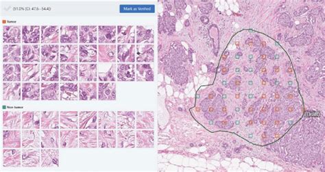 An Interface Preserving Visual Context To The Left Are Image Patches Download Scientific