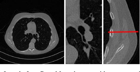 figure 2 from rising a new framework for few view tomographic image
