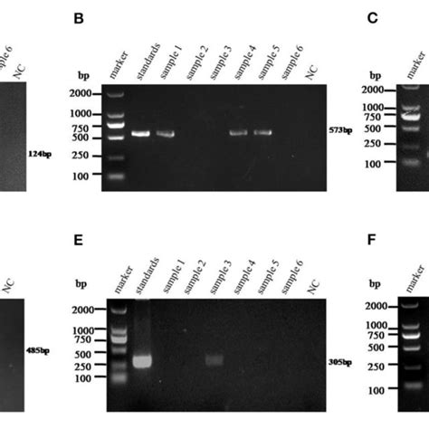 Detection Consistency Analysis Of Multiplex And Monoplex Pcr Used In